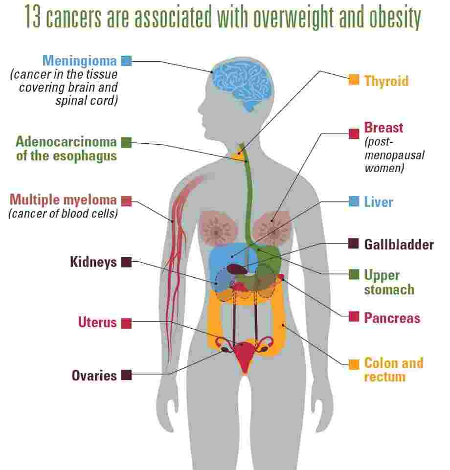 List Of Non communicable Diseases Causes Symptoms Treatment