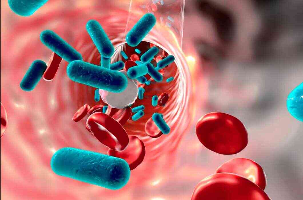 Names Of Diseases Caused By Bacteria Names Of Diseases Caused By Bacteria