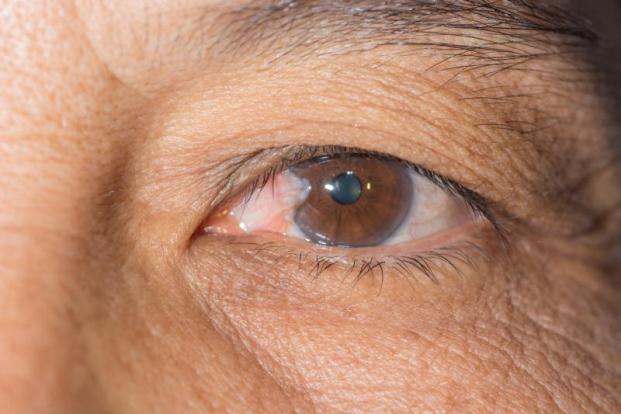 Common Eye Diseases: List of Most Common Eye Diseases in India ...
