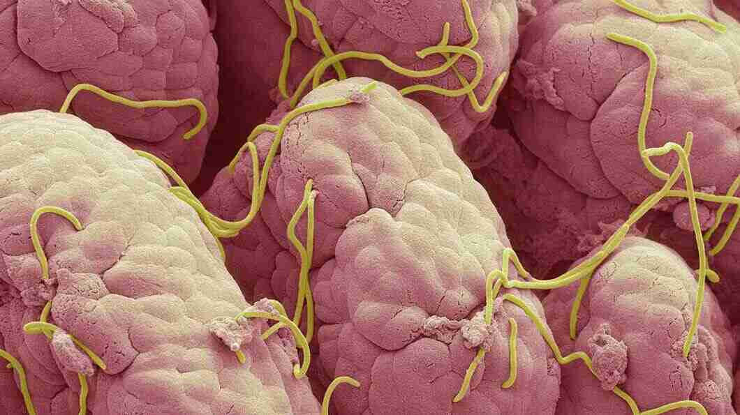 Intestinal Worms: Risk, Symptoms, Causes & Treatment