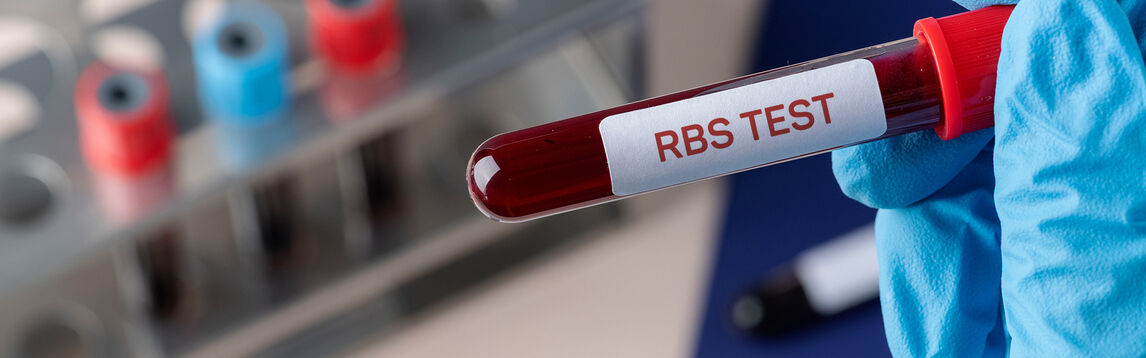 What is Random Blood Sugar (RBS) Test & it's Procedure