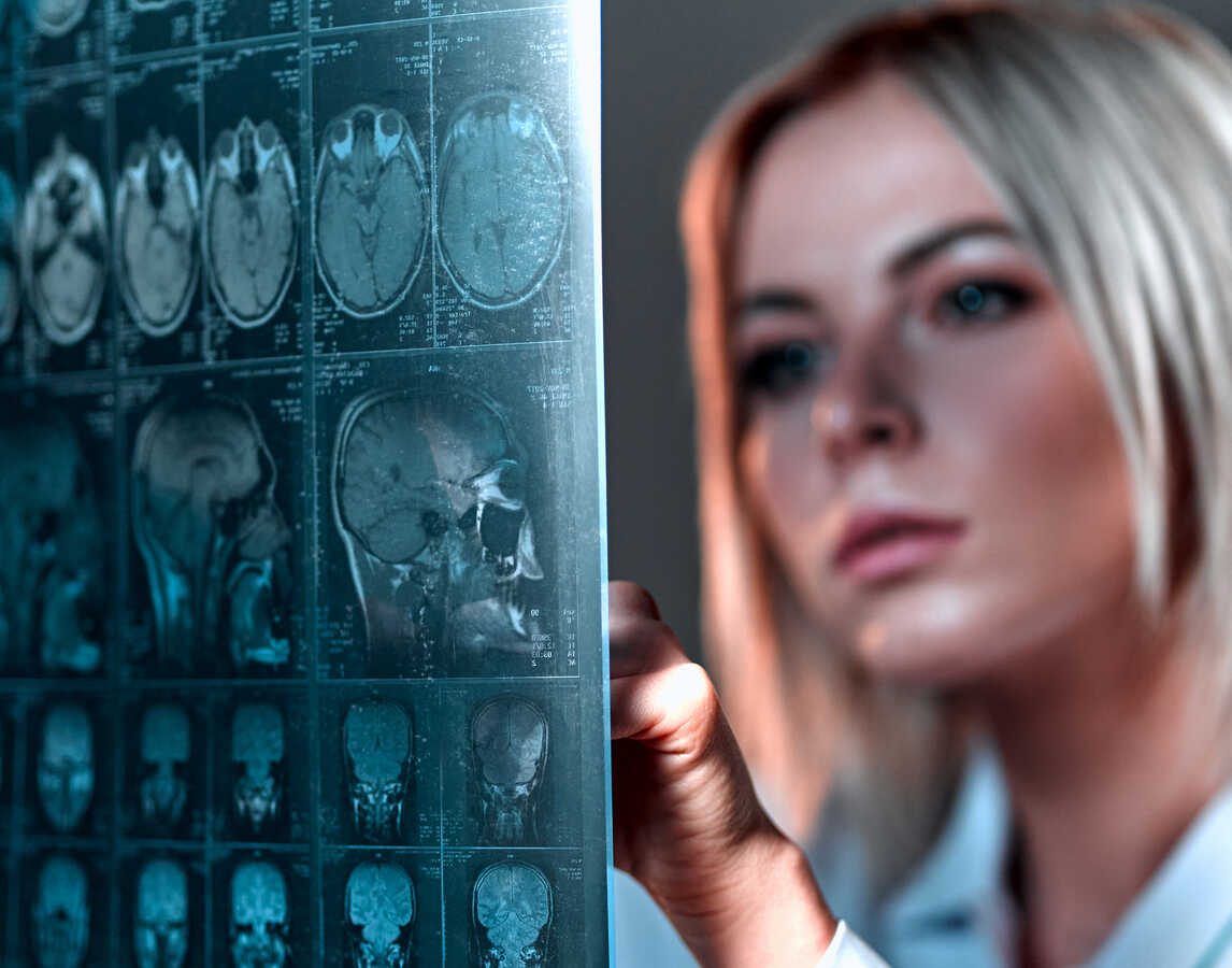 ventriculostomy-procedure-meaning-types-how-to-prepare-risks